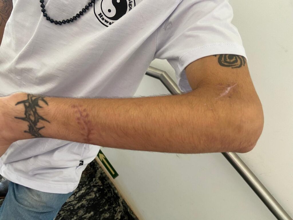 Jovem esfaqueado na Lagoa dos Pássaros recebe alta